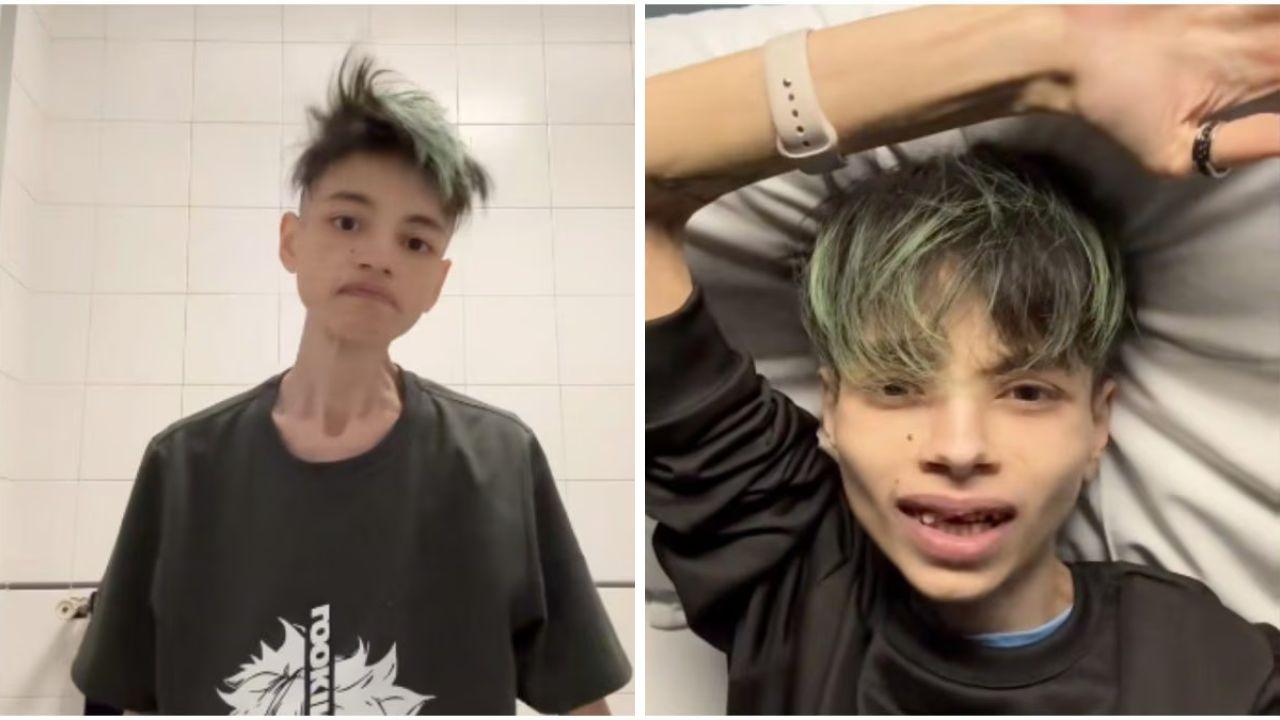 Thiago Elar è morto a 27 anni: addio al tiktoker che raccontava la sua ...