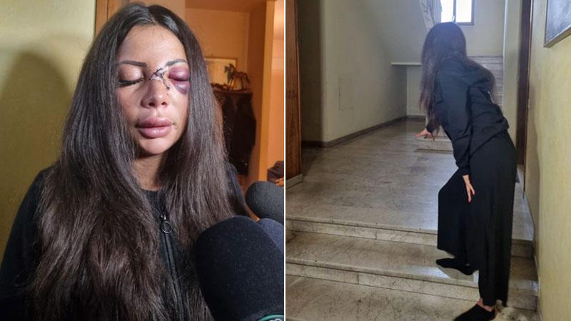 Prato, barista di 28 anni pestata: non è stata solo una rapina. Ci sono dei sospetti - Il Tirreno