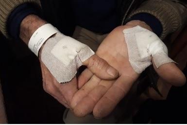 "Sono stato morso da un lupo": si era inventato tutto - Il Tirreno